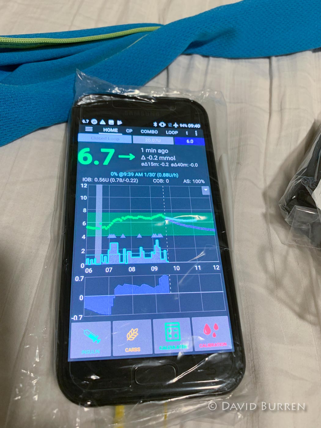 In Hospital With A Closed Loop Pump
