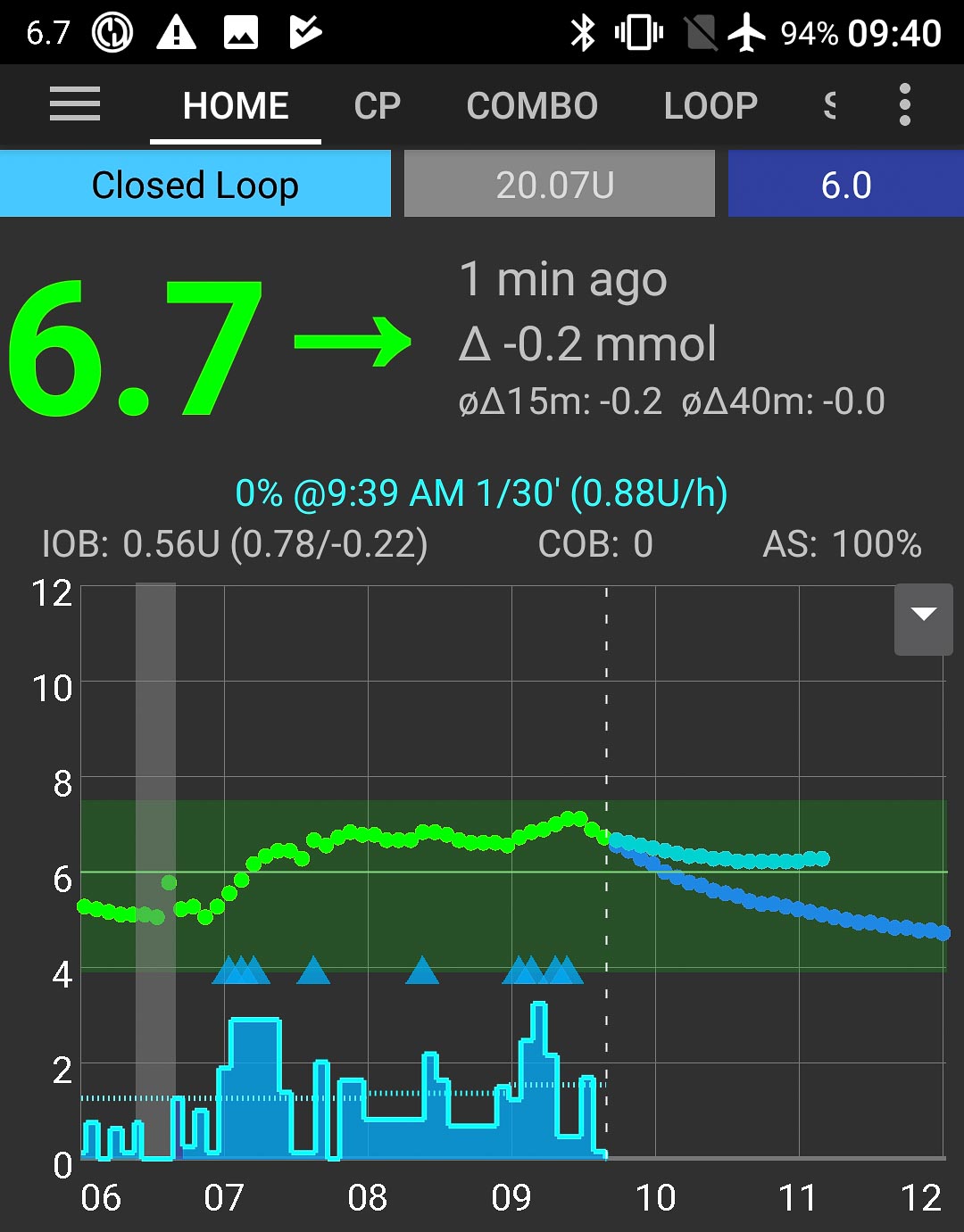 In Hospital With A Closed Loop Pump